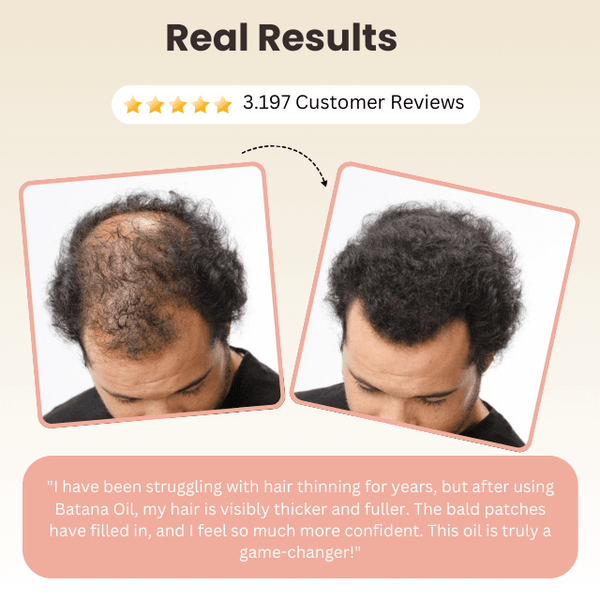 Raw Batana Oil – Batana Oils